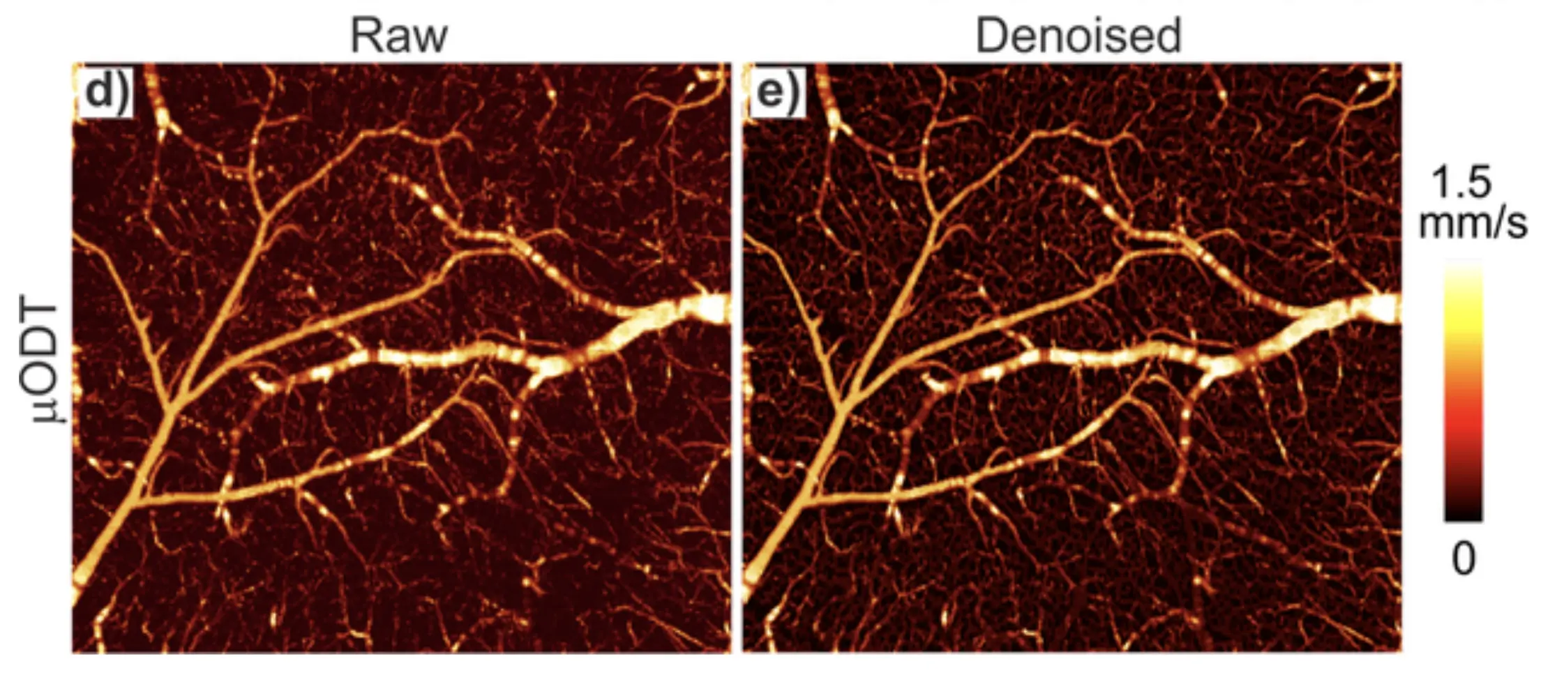 Self-supervised learning for denoising: A Breakdown